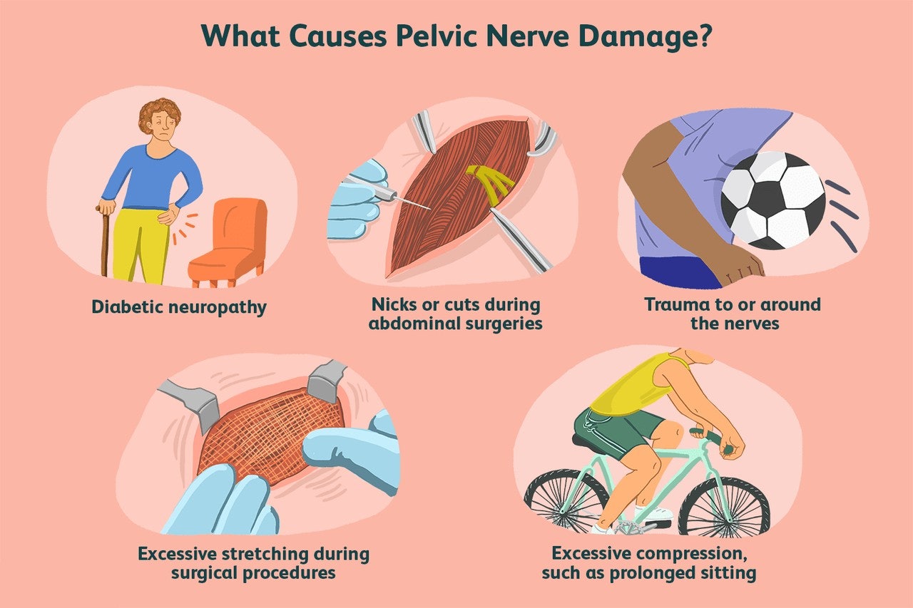 오늘은 알콕스 증후군(Alcock's syndrome) : 네이버 블로그