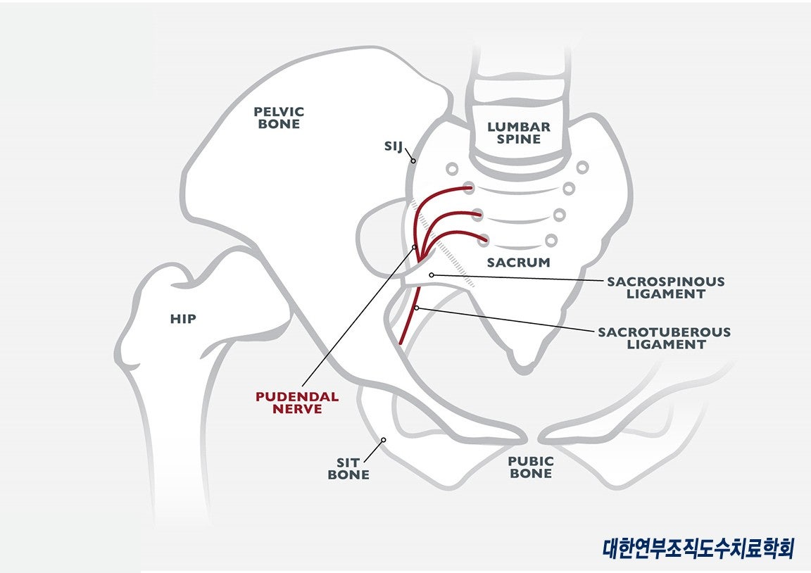 오늘은 알콕스 증후군(Alcock's syndrome) : 네이버 블로그